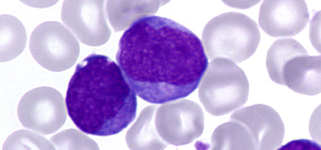 Genetic study further explains leukemia mechanisms