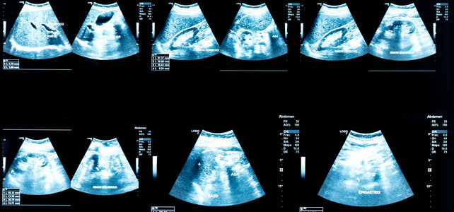 Systematic Review: Ultrasound Goes Echo—Decarbonising Inflammatory ...